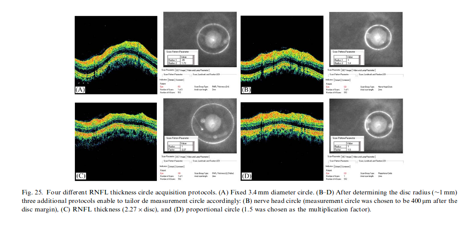 Retinal assessment using optical coherence tomography | Hawaii On Line University Bible College